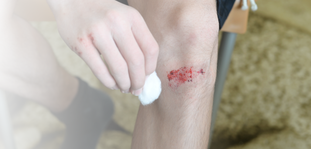 Wundversorgung: 1. Hilfe bei Wunden